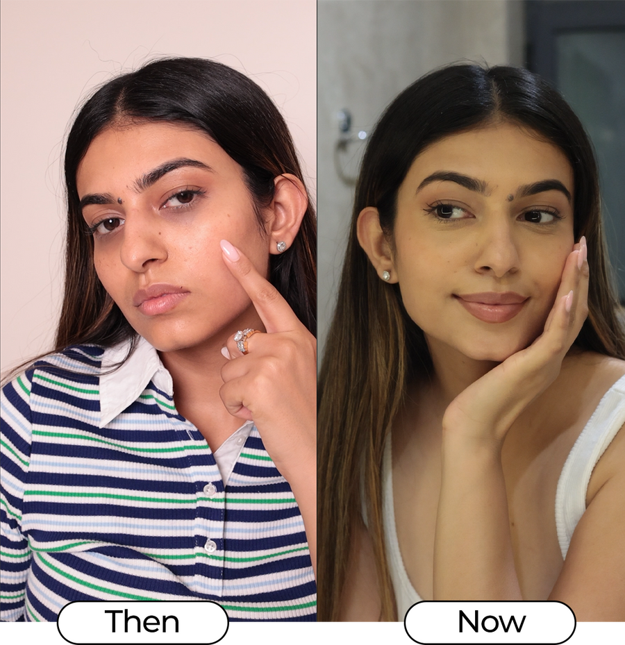 Under Eye Care Roll-On By Dr.Veda for Dark Circles, Puffiness & Fine L